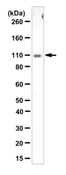 Anti-Dihydropyrimidine dehydrogenase/DPYD Antibody | ABC451